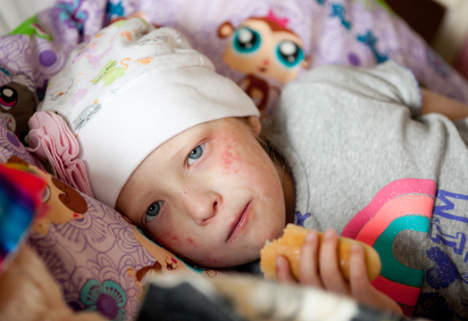 Childhood Neuroblastoma – Treatment - ACCO